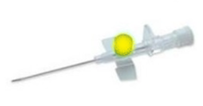 Cathéter Court Intraveineux à Ailette Versatus Sécurisé Jaune Terumo ...